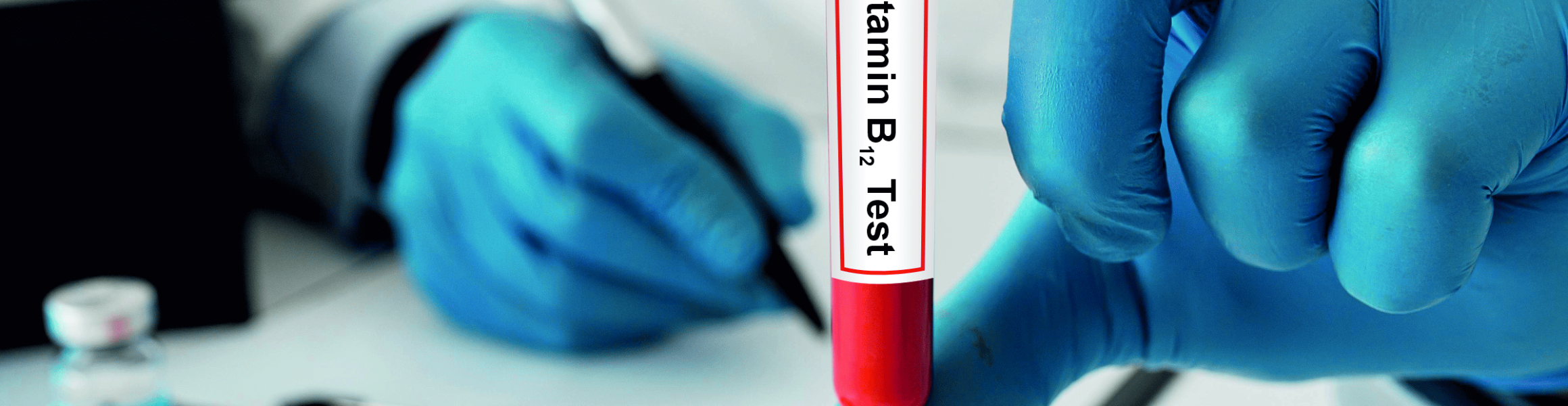 Vitamin B12 Test: Why It’s More Important Than You Think – Diagnostics ...