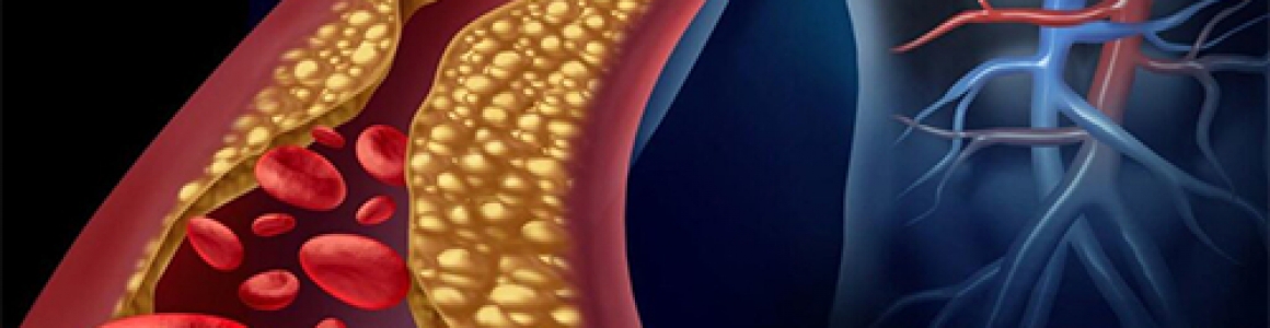 Cholesterol Test: A Key to Heart Health – Diagnostics Division